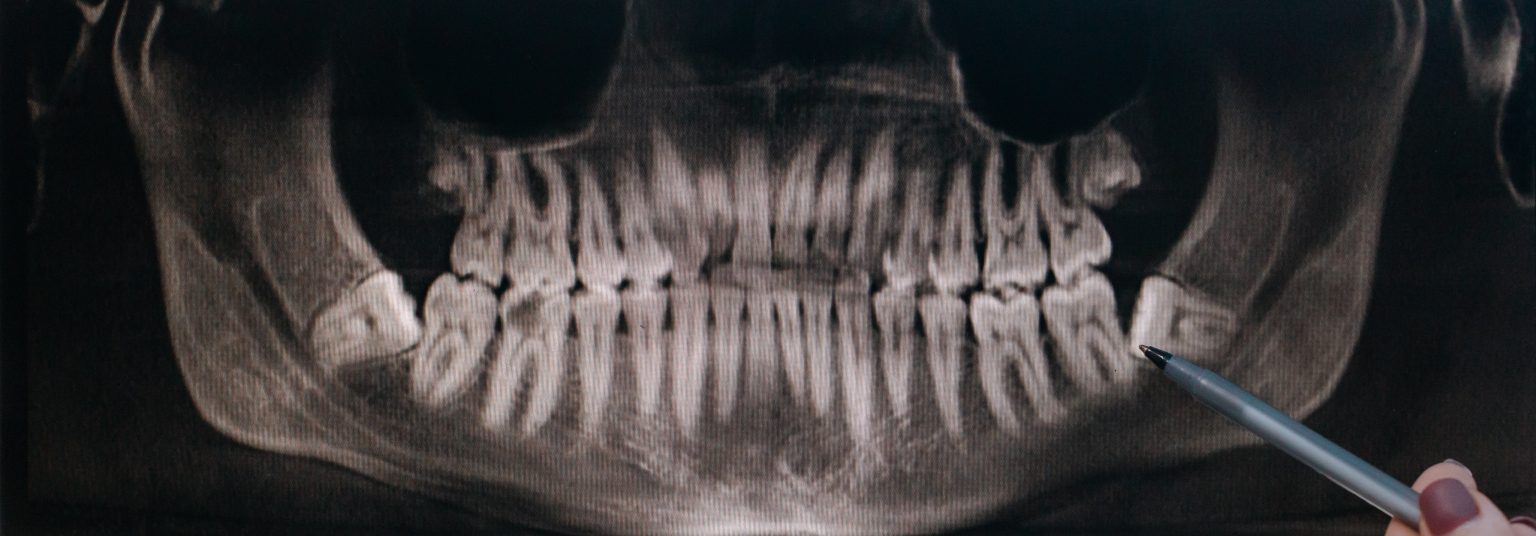 Digital Imaging - The Oral Surgery Institute