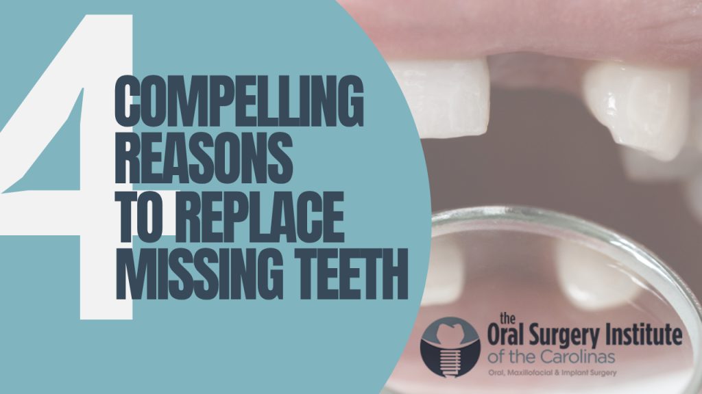 Missing Teeth? 4 Compelling Reasons to Restore Your Smile