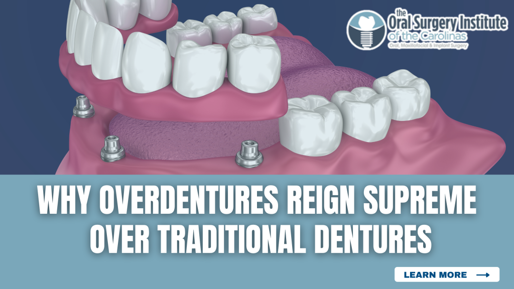 Traditional Dentures vs. Overdentures: The Superior Choice